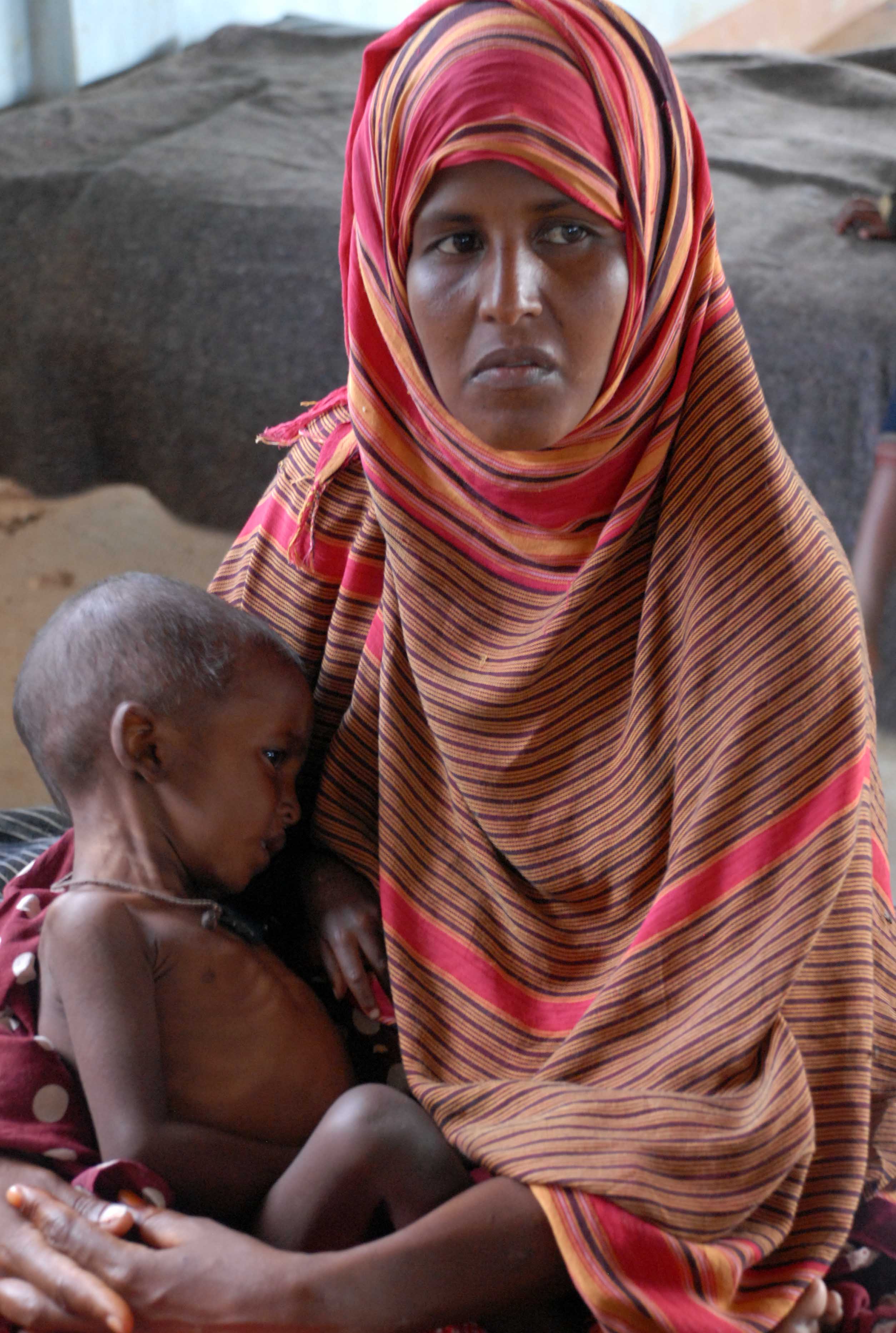 A mother holds her malnourished child in one of the wards for refugees ...