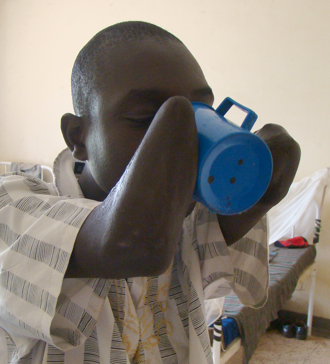 Charles Opio holds a cup with his arms. He suffered injuries at the ...