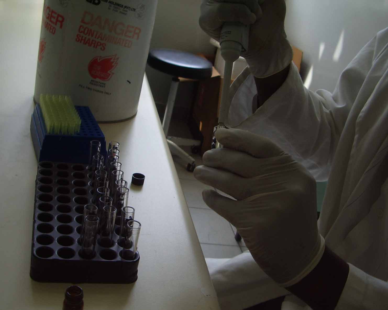 A laboratory technician at Harare Hospital processes CD4 count tests ...
