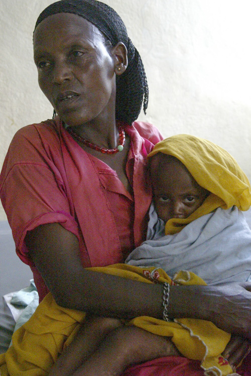 Ayane Beyago holds her malnourished three year-old son, Mubarek Ababa ...