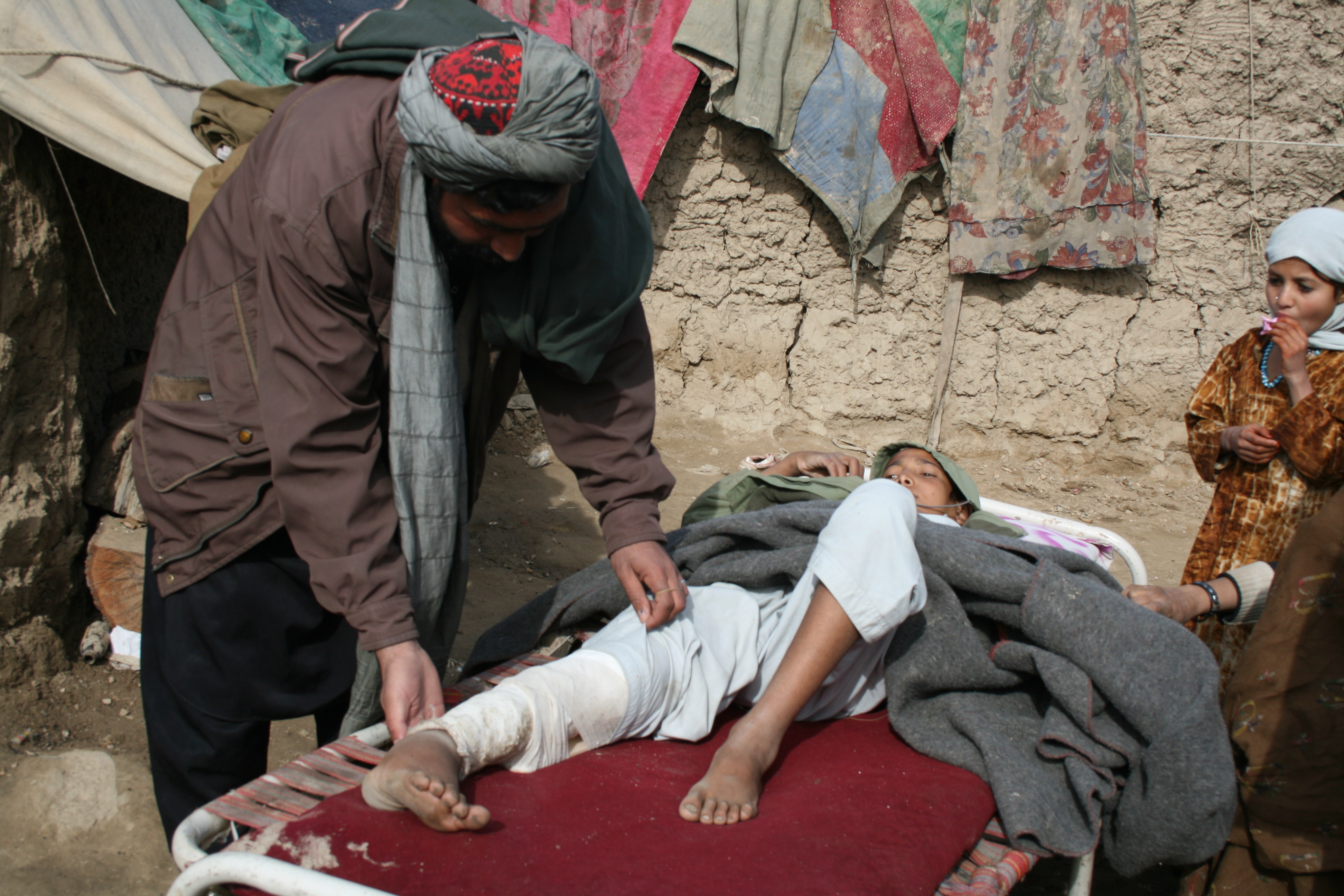 15 years old Ahmad Wakil was injured after their house was bombed in a ...