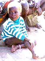 Camacupa Malnutrition | The New Humanitarian