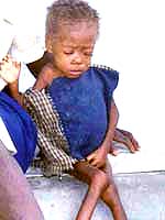 Camacupa Malnutrition | | The New Humanitarian